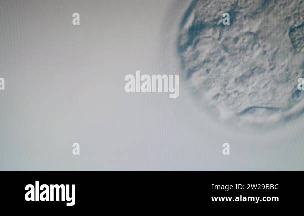 A cell moving under a microscope in laboratory. Ivf, In Vitro ...