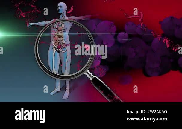 Diseases cartoon Stock Videos & Footage - HD and 4K Video Clips - Alamy