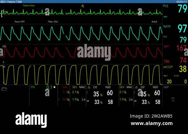 Hospital computer screen Stock Videos & Footage - HD and 4K Video Clips ...