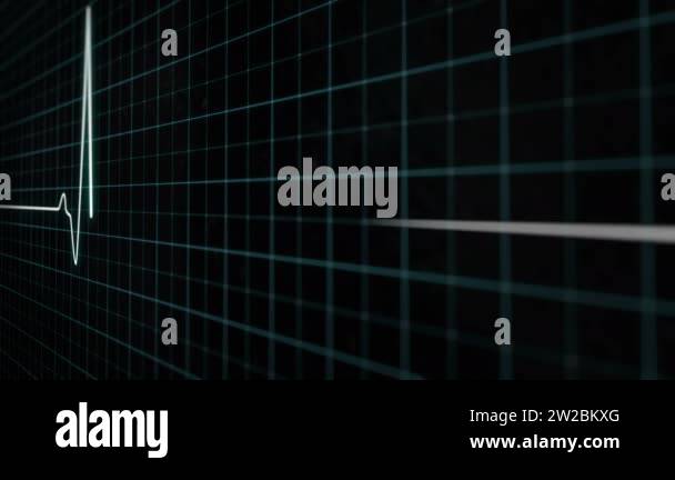 Heart chart and heart Stock Videos & Footage - HD and 4K Video Clips ...