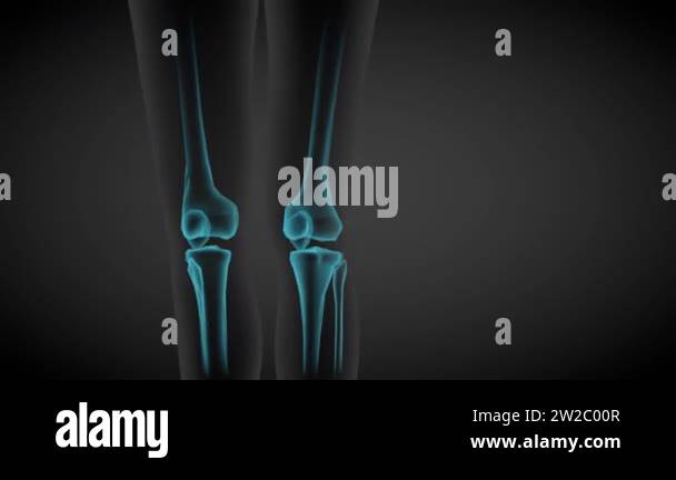 2 3D seamless looping animations in 1, female body rotating - x-ray ...