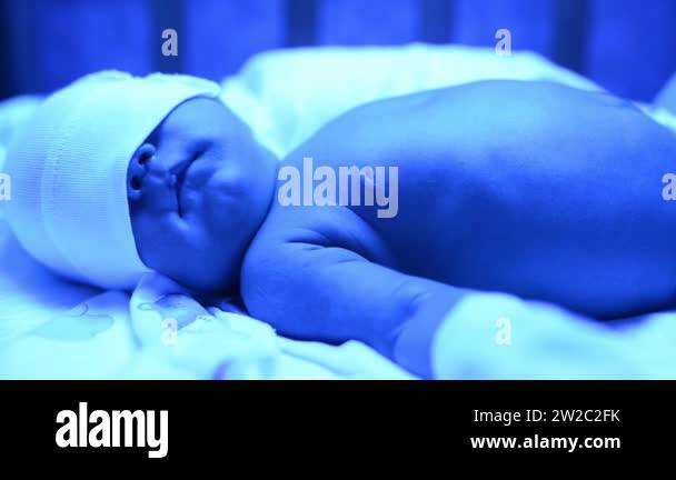 Newborn having a treatment for jaundice under ultraviolet light, Baby ...