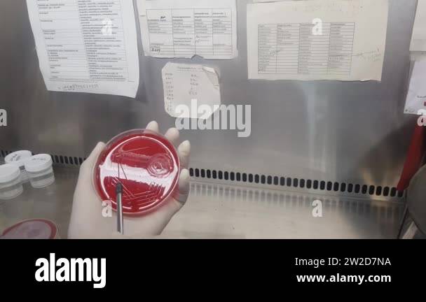 inoculation of sample in a blood agar culture plate by an inoculation ...