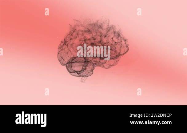 3D animation of brain neurons ruining, causing mental illness ...