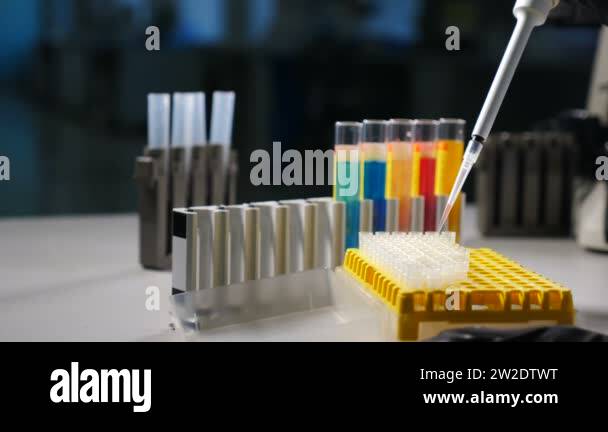 Lab assistant makes urgent blood test for detection of antibodies and ...