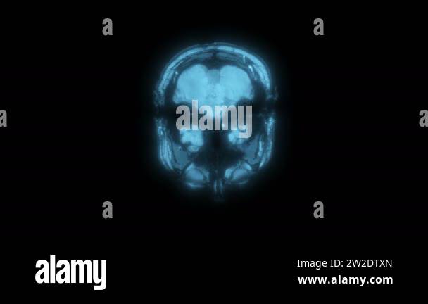 Magnetic Resonance Imaging MRI scan of a Human brain, ultra hd 4k, time ...