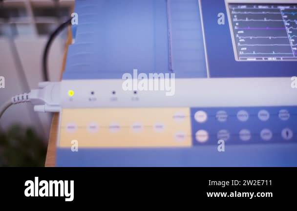Electrocardiography Stock Videos & Footage - HD and 4K Video Clips - Alamy