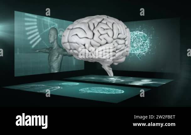 Human brain scan development Stock Videos & Footage - HD and 4K Video ...