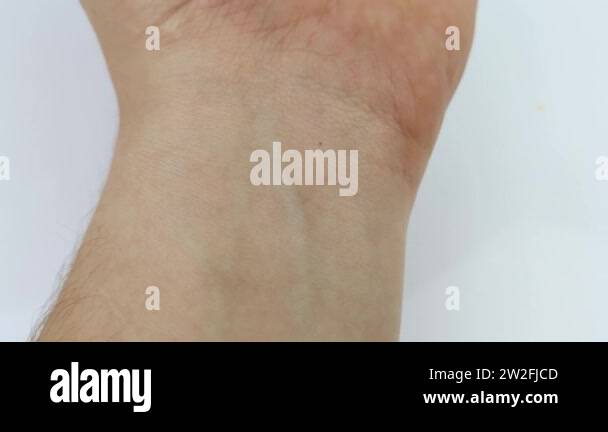 The patient compresses and unclenches the fist stimulating the flow of ...