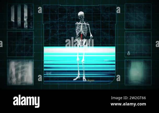 Digital graphic scan human spine focus trigger point and have particle ...