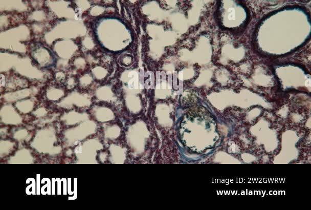 Lung tissue Stock Videos & Footage - HD and 4K Video Clips - Alamy