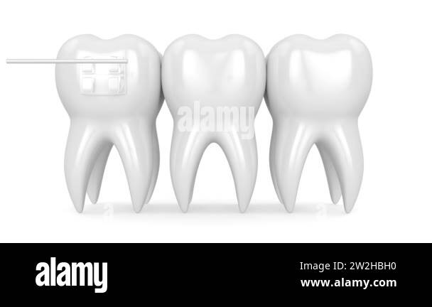 Three teeth Stock Videos & Footage - HD and 4K Video Clips - Alamy