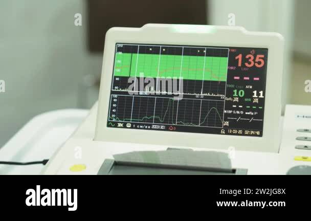 EKG monitor Cardiograph. Cardiograph display during the measurement of ...
