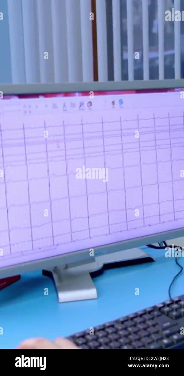 Medical heart monitor strip. Heart monitor printing electrocardiogram ...