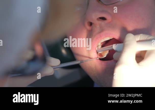 Periodontal probe Stock Videos & Footage - HD and 4K Video Clips - Alamy
