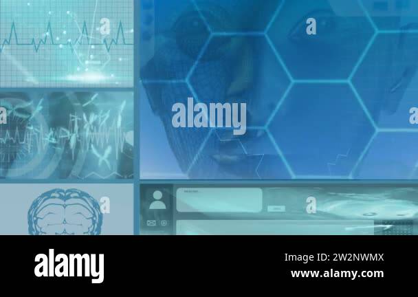 Animation of screens with 3d human model, human brain, scope scanning and recording, medical ...