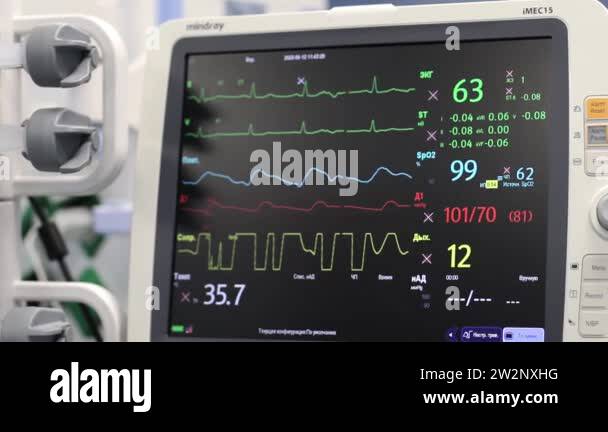 Heart rate monitor in hospital theater. Medical vital signs monitor ...