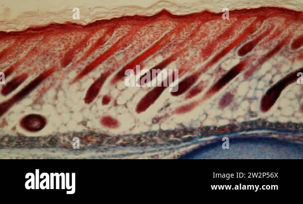 Tissue section through the mouse snout with whisker hair under the ...