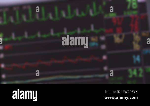 Vital signs monitor during surgery Stock Videos & Footage - HD and 4K ...