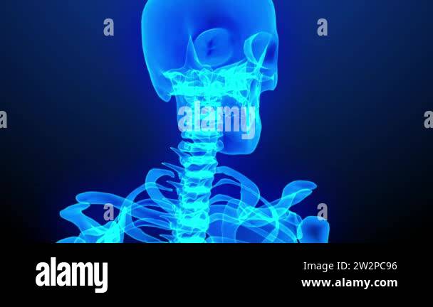 X ray sequence Stock Videos & Footage - HD and 4K Video Clips - Alamy