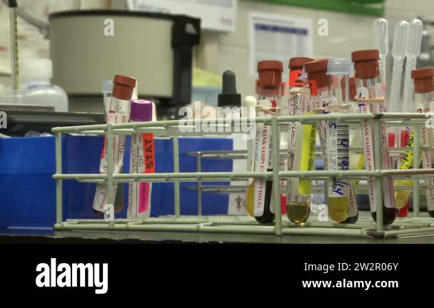 A view of typical work inside a medical laboratory Stock Video Footage ...