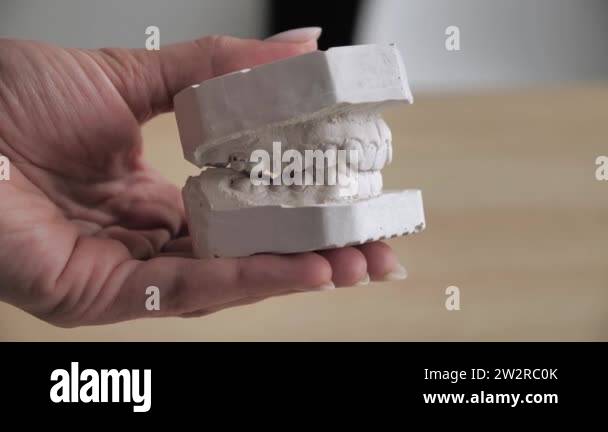 dental plaster cast in female hands. Doctor closes and opens the ...