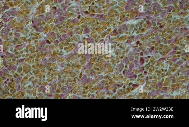 pituitary gland tissue under the microscope 200x Stock Video Footage ...