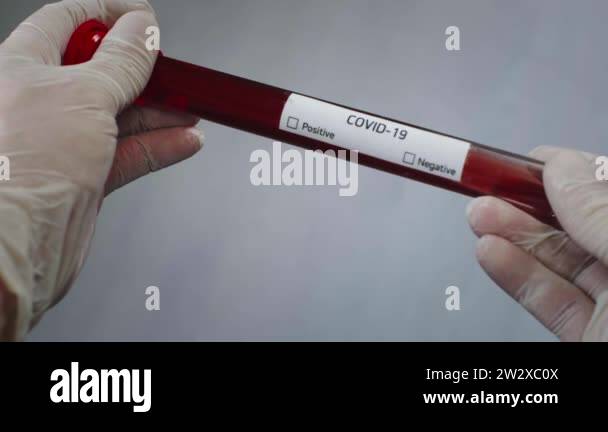 The virologist is holding a test tube with a blood sample infected with ...