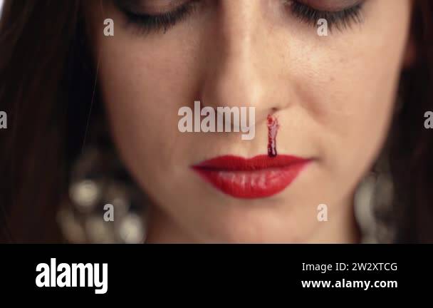 Close-up of bleeding nose of young girl, real scary emotions, injury ...