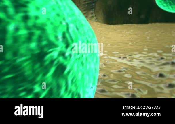 Stomach polyps Stock Videos & Footage - HD and 4K Video Clips - Alamy