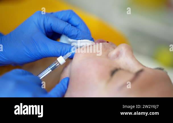 Woman getting injection beauty Stock Videos & Footage - HD and 4K Video ...