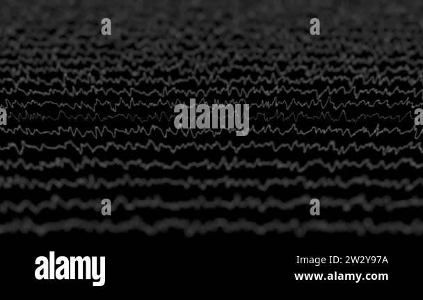 White lines forming distorted field visualization on black background ...
