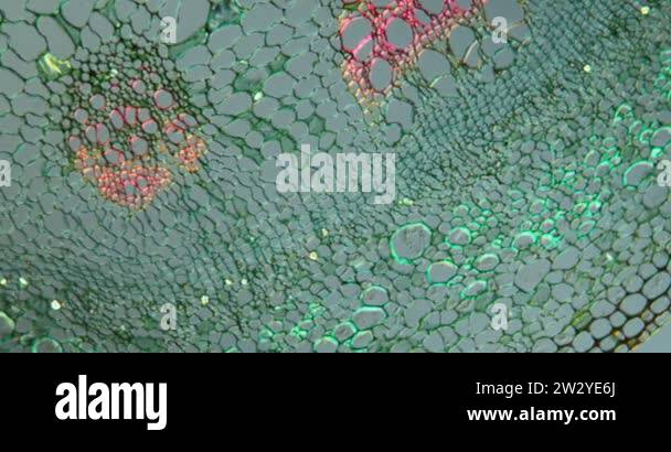 Nettle cells Stock Videos & Footage - HD and 4K Video Clips - Alamy