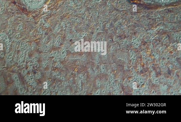 Adrenal gland tissue Stock Videos & Footage - HD and 4K Video Clips - Alamy