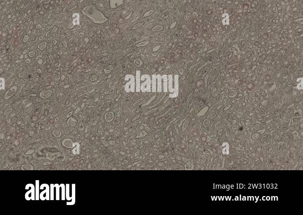 Human body structure with connective tissue Stock Videos & Footage - HD ...