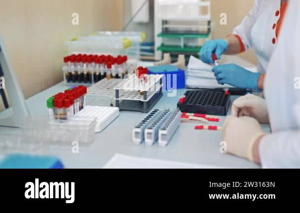 Young female nurse puts blood samples in tubes into a special rack on a ...