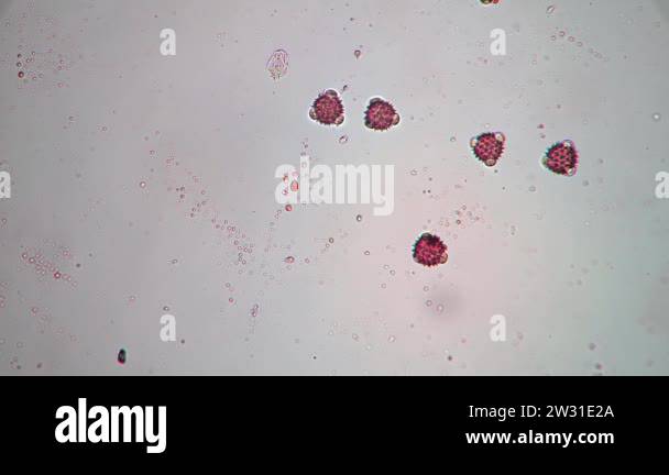 Round spiked cells that look like a coronavirus covid-19 virus ...