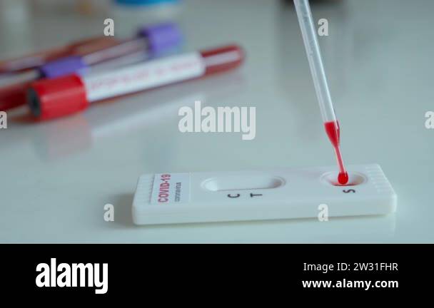 Lab card Stock Videos & Footage - HD and 4K Video Clips - Alamy