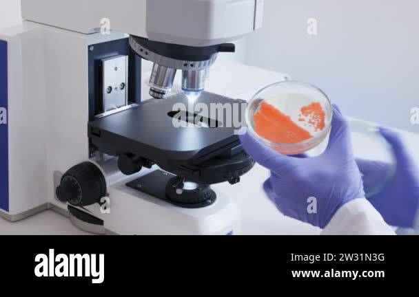 Petri dish bacteria under microscope Stock Videos & Footage - HD and 4K ...