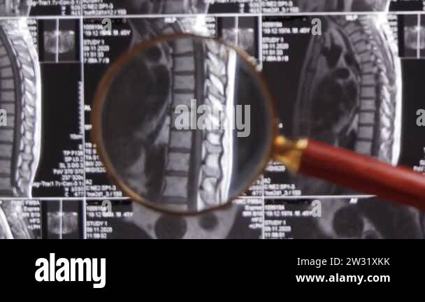 MRI lumbar spine background, magnetic resonance tomography. Doctor ...