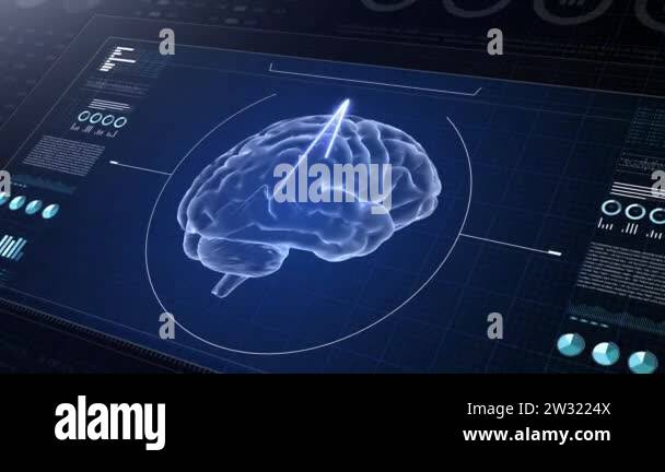 Laboratory dashboard interface 4K. Human brian study on diagnostic ...