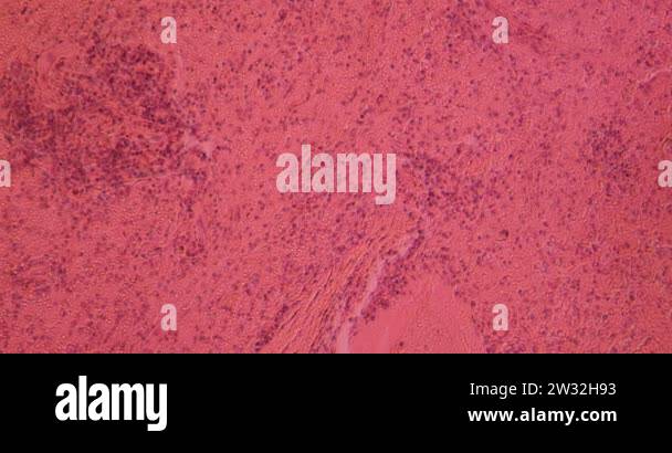 Tissue inflammation microscope Stock Videos & Footage - HD and 4K Video ...