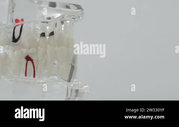 The layout of the human jaw on a white background with bad teeth. The ...