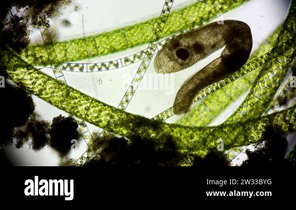 algae and microorganisms under the microscope Stock Video Footage - Alamy