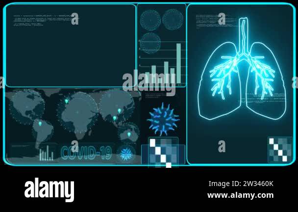 Covid virus spread all world analysis and digital graph bar keyboard ...