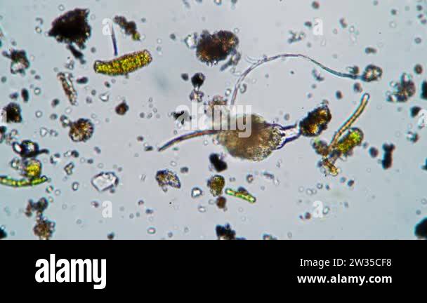 A large rotifer worm feeds between algae and mud in a drop of water ...