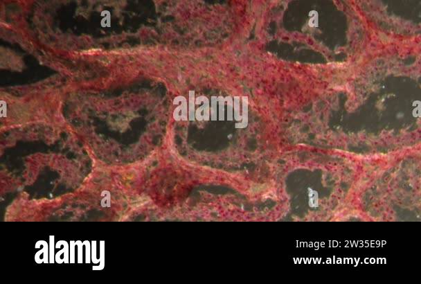 Inguinal testicles in Darkfield tissue under the microscope 100x Stock ...
