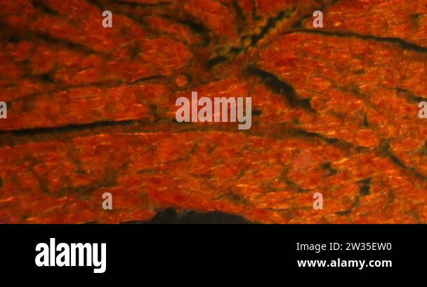 Ovarian cyst in Darkfield tissue under the microscope 200x Stock Video ...