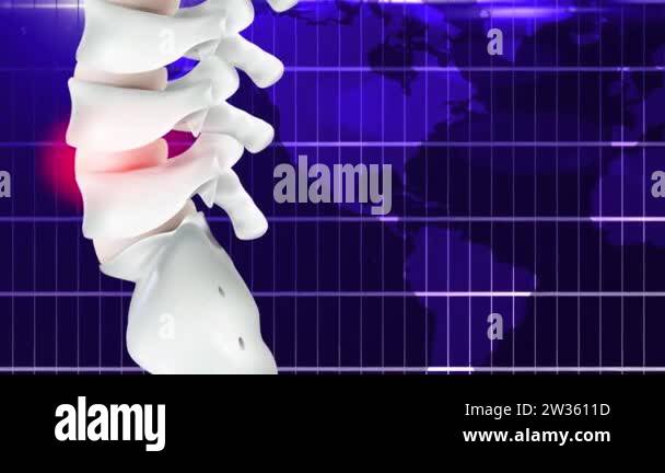 Vertebral syndrome Stock Videos & Footage - HD and 4K Video Clips - Alamy