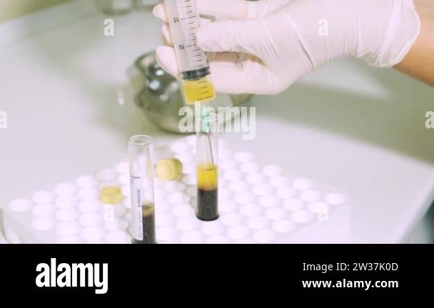 Platelet-Rich plasma preparation. Plasma in syringe. Centrifuge ...